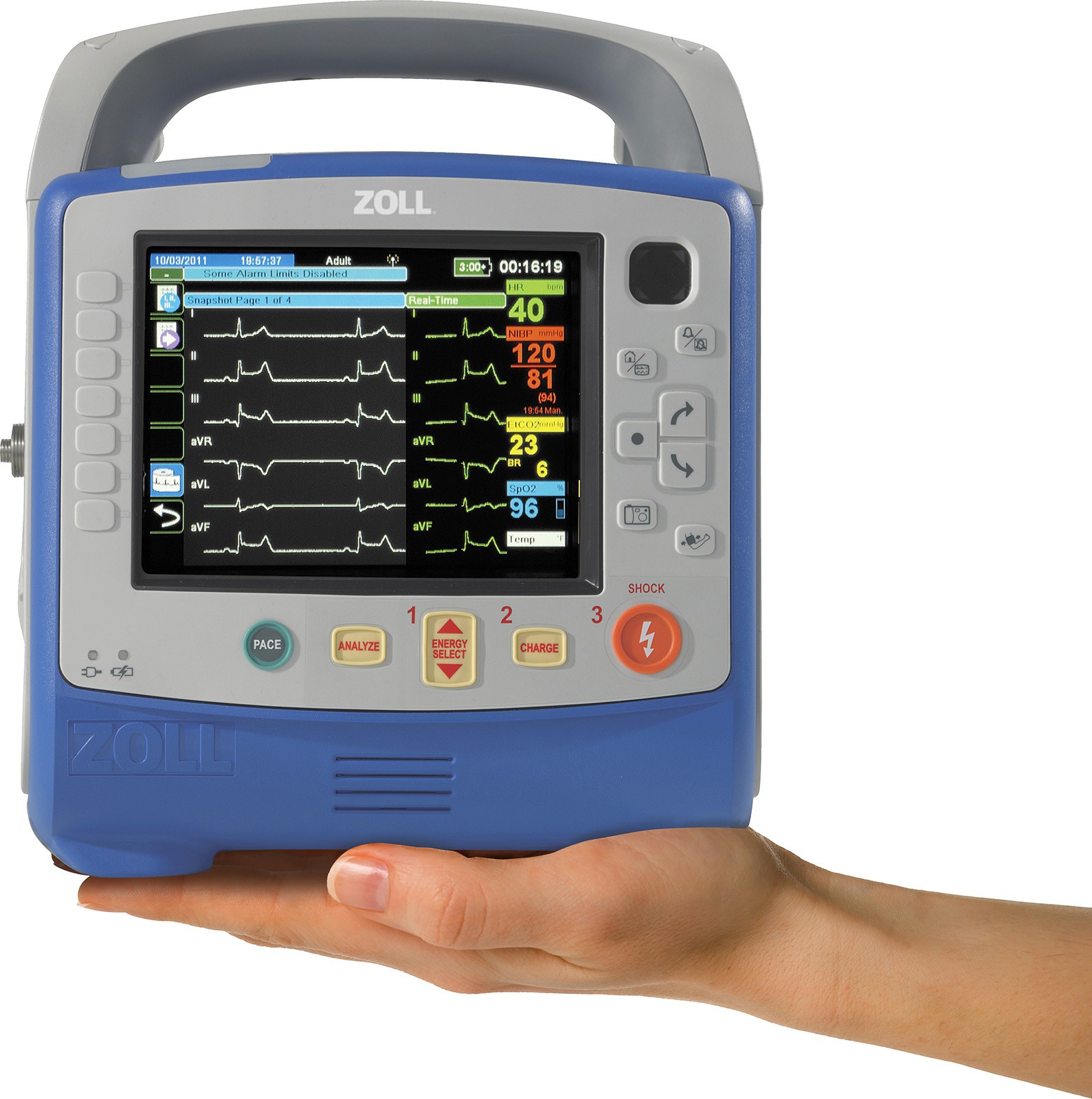 X Series (ZOLL) - ParaMedica MIL-SYS